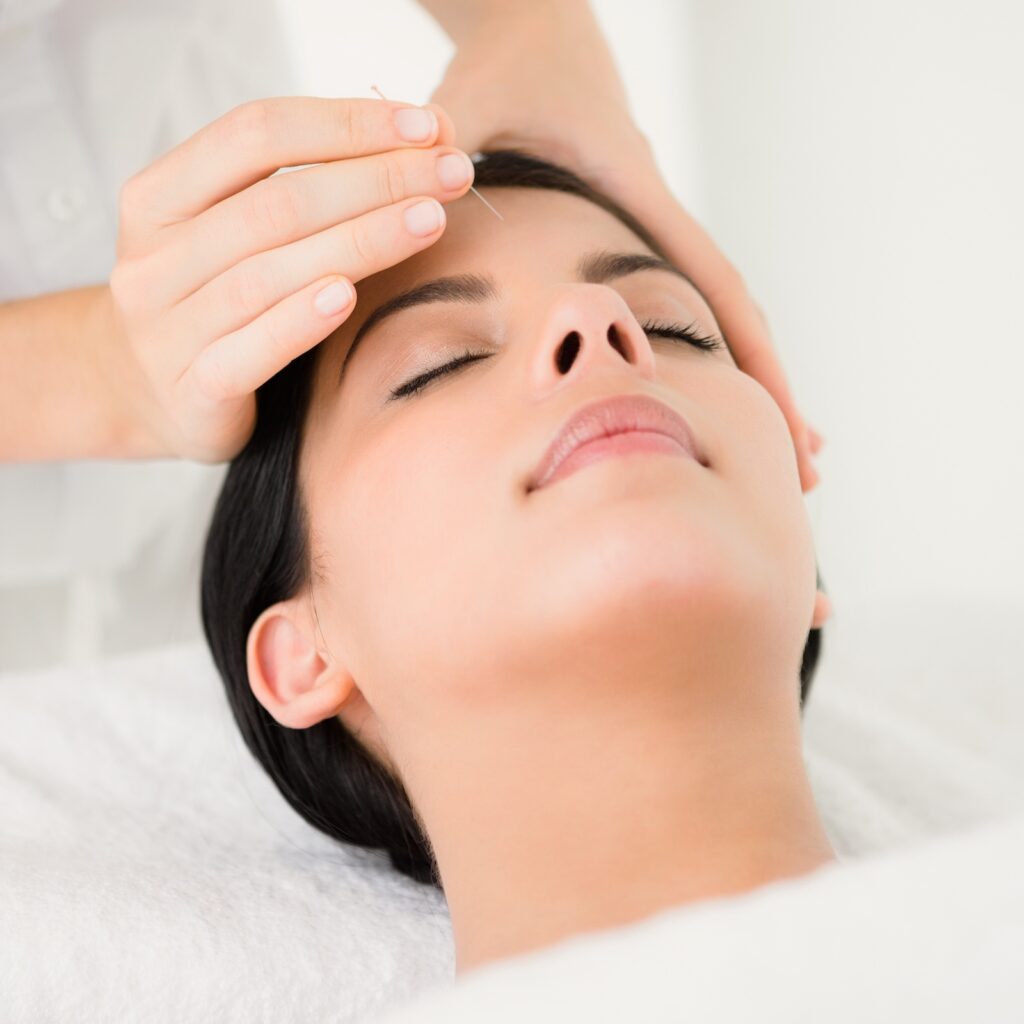 Acupuncture in Media, PA | Pain Relief & Wellness Care